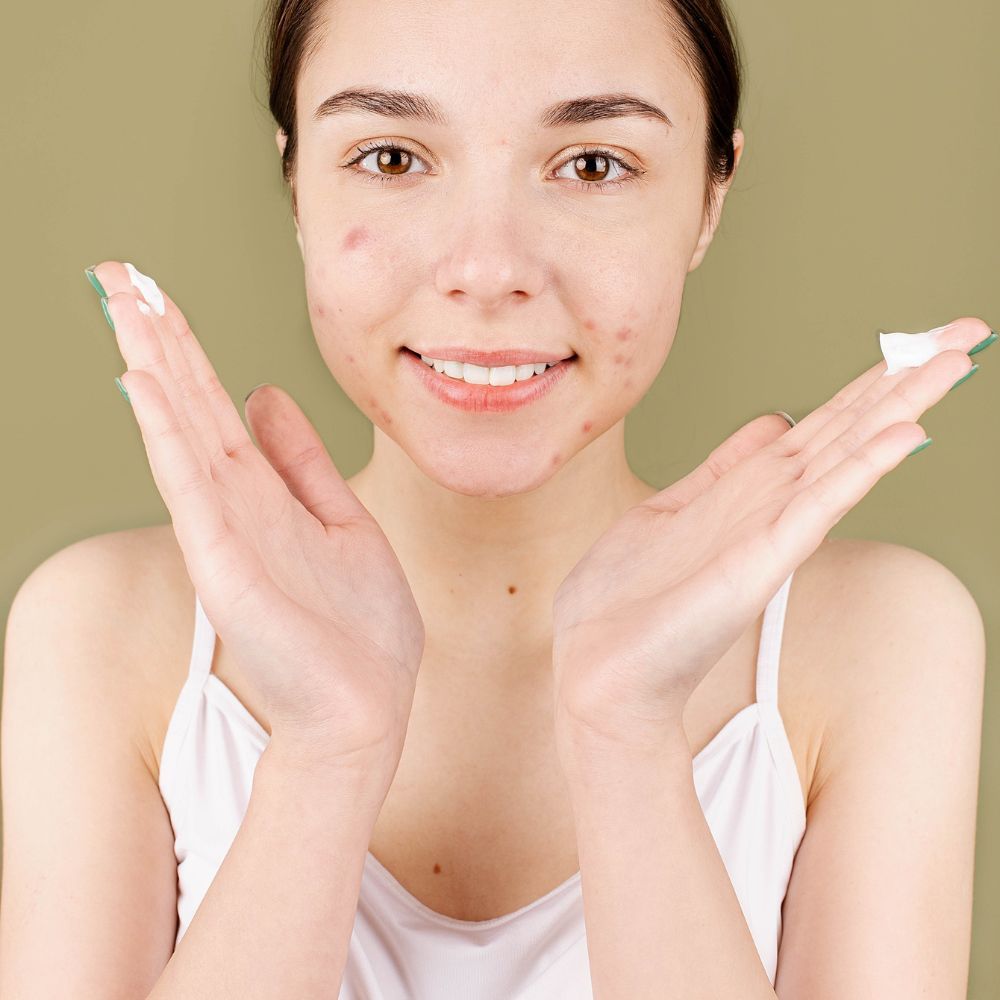 The Best Foundation For Acne Prone Skin That Will Make You Look